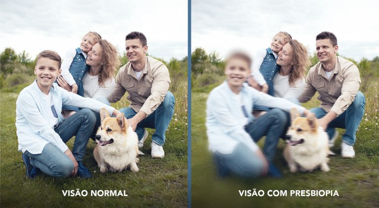 Entenda como pessoas com diferentes problemas de visão enxergam - Visão ...